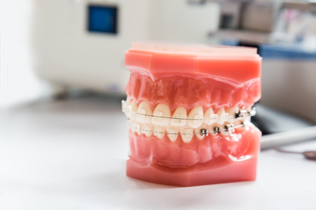 歯列矯正を早く始めるべき理由8点 | 裏側矯正専門クリニックは大阪難波の「難波矯正歯科」